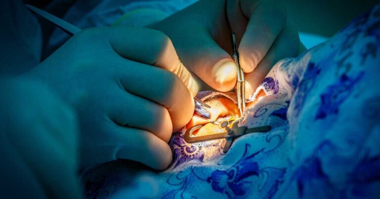 Cirugía de Vitrectomía - COM